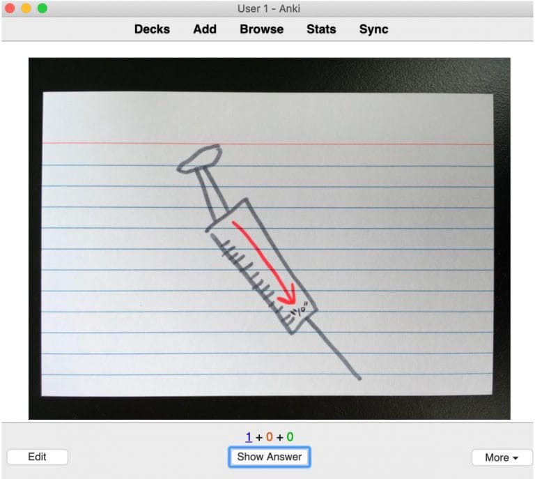 The No-Fluff Anki Guide for Serious Learners (2025)