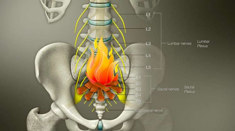 Effective Sacral Plexus Mnemonic Lumbar Plexus Mnemonic