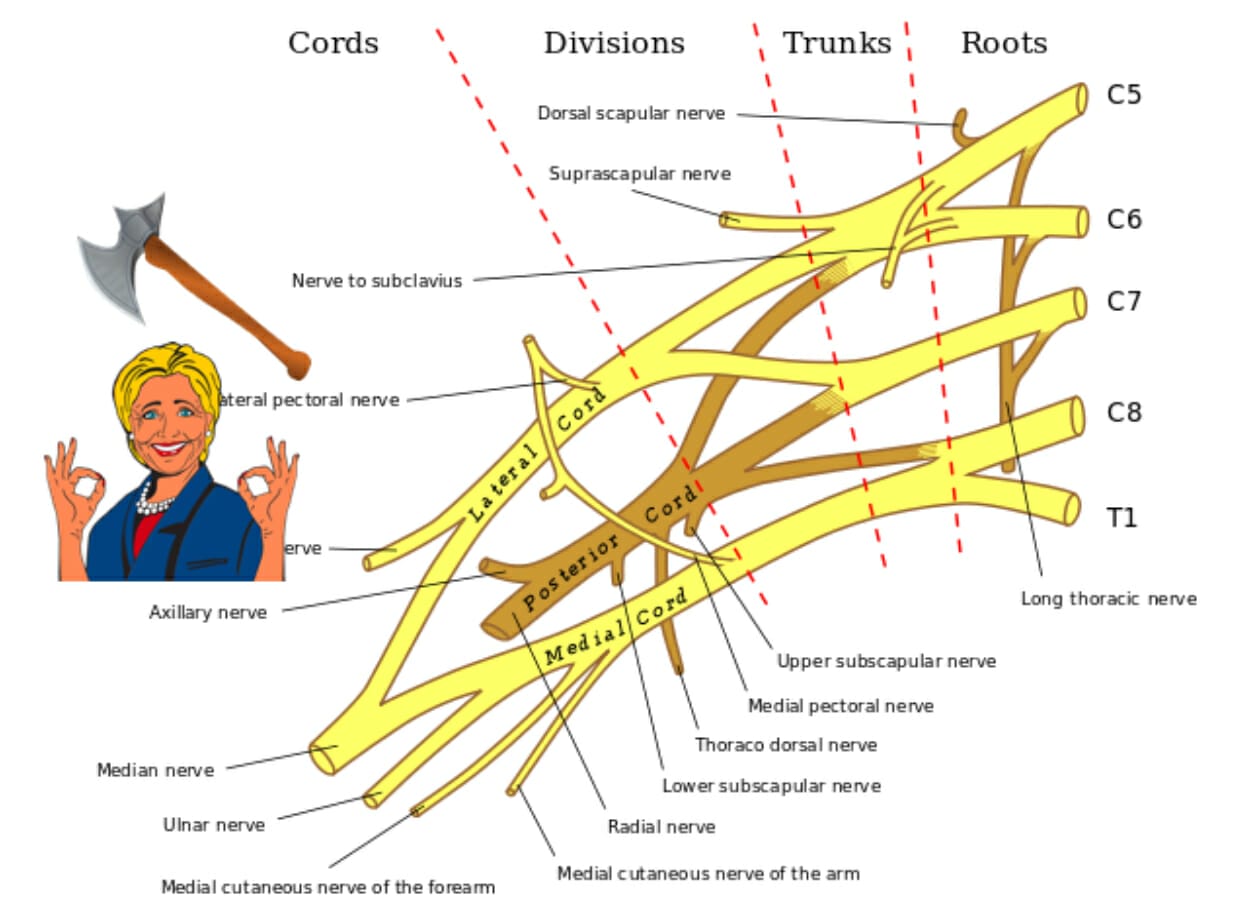 The Most Effective Brachial Plexus Mnemonic You'll Find